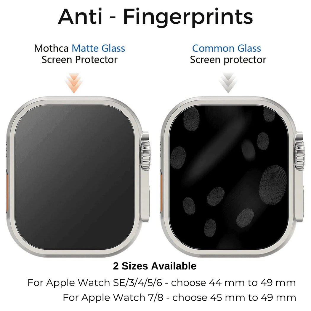 Apple Watch Mods – DREAM WATCHES